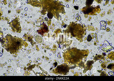 soil microorganisms in a soil sample, soil fungus and bacteria on a ...