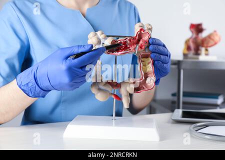 Gastroenterologist showing human colon model at table in clinic ...