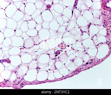 White adipose tissue, light micrograph Stock Photo - Alamy