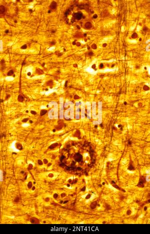 Light micrograph of the cerebral cortex stained with Cajal silver ...