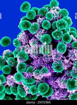 Staphylococcus epidermidis bacteria Stock Photo - Alamy