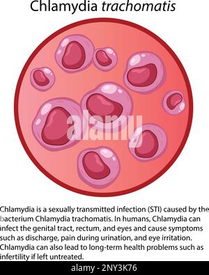 Chlamydia trachomatis with explanation illustration Stock Vector Image ...