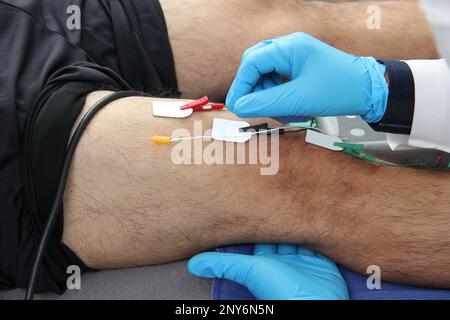 Electromyography EMG and Somatosensory Evoked Potential PEV of lower ...
