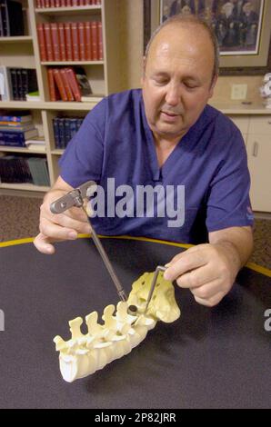 Spinal implant in lumbar fusion. Coloured lateral 3D computed ...