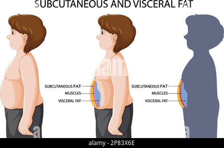 Subcutaneous and visceral fat diagram illustration Stock Vector Image ...
