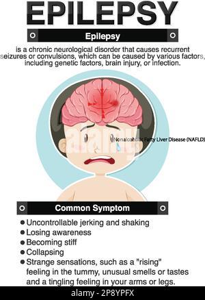 Informative poster of Epilepsy illustration Stock Vector Image & Art ...