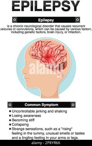Informative poster of Epilepsy illustration Stock Vector Image & Art ...