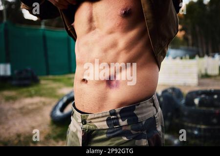 Paintball injury, stomach bruise and man in closeup with pain, shooting ...