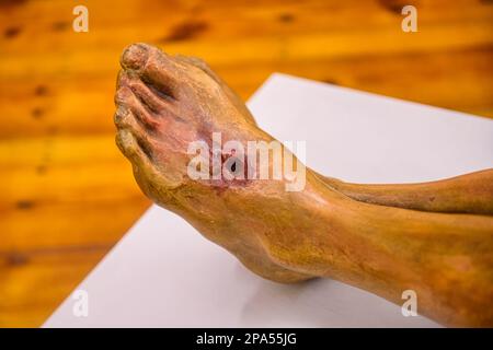 Nail wounds of Jesus Christ recreated by a 3D artist based on the Turin Shroud.Church of Saint ...