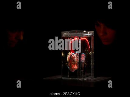 Dissected human heart Stock Photo - Alamy