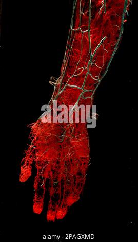 Preserved human body dissected to display the internal organs. It is ...