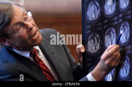 Dr. David Brooks, surgeon at Brigham and Women's Hospital, indicates ...
