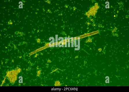 Microscopic view of various species of freshwater algae. Brightfield ...