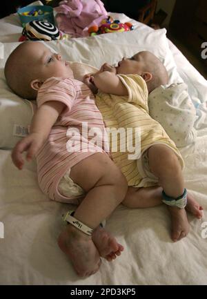 Twin sisters Abby, left, and Isabelle Carlsen pose for a photo taken by ...