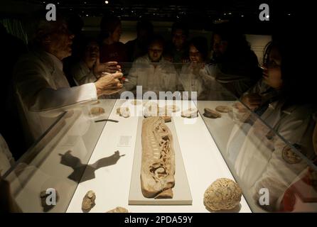A group of visitors observes a disected cadaver during the exhibit ...