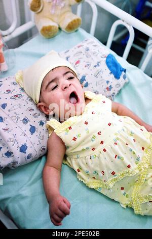 Egyptian baby girl Manar Maged, who was born March 30, 2004 with a rare ...