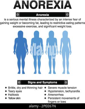 Anorexia (Anorexia) and Its Effects on the Body illustration Stock ...