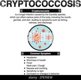 Informative poster of Cryptococcosis illustration Stock Vector Image ...