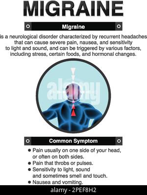 Informative poster of Migraine illustration Stock Vector Image & Art ...