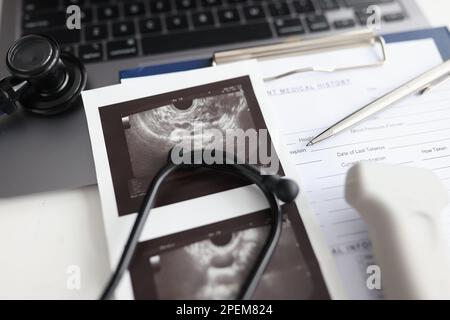Modern ultrasound device with sensor and ultrasound of uterus Stock ...