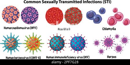 Common Sexually Transmitted Infections (STI) illustration Stock Vector ...
