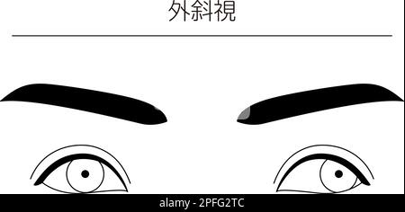 Medical illustrations, diagrammatic line drawings of eye diseases ...