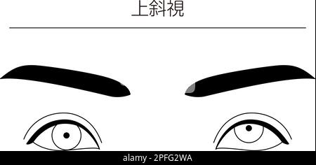 Medical illustrations, diagrammatic line drawings of eye diseases ...