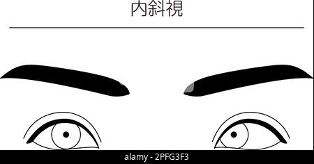 Medical illustrations, diagrammatic line drawings of eye diseases ...