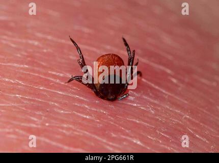 Tick (Acarina sp.) adult, feeding, on human skin with inflammation ...
