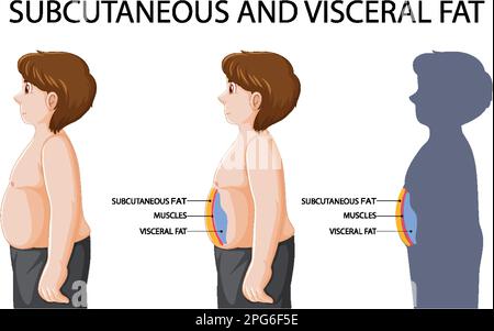 Subcutaneous and visceral fat diagram illustration Stock Vector Image ...