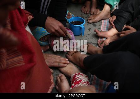 Srinagar, India. 21st Mar, 2023. Residents receive leech treatment on ...