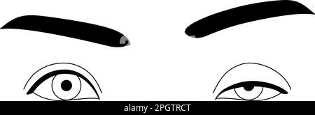 Medical illustration: Diagram of moderate ptosis (eyelid drooping ...