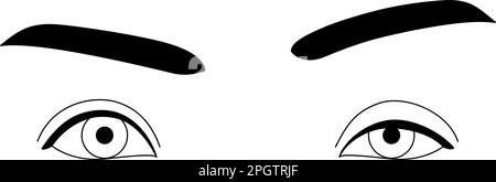 Medical illustration: Diagram of moderate ptosis (eyelid drooping ...