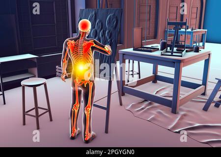 Artist with back pain, illustration Stock Photo - Alamy
