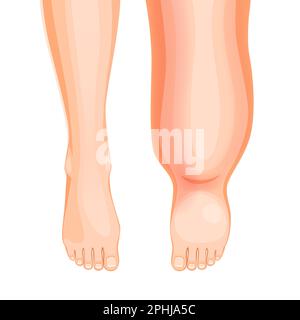 pregnant overweight vector. health pregnancy, woman healthy, weight fat ...