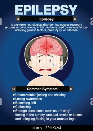 Informative poster of Epilepsy illustration Stock Vector Image & Art ...