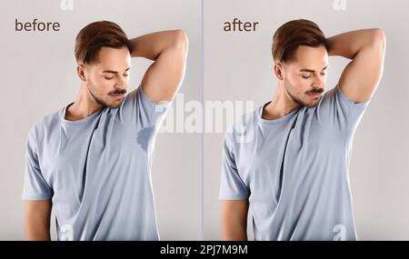 Man before and after using deodorant on light background, closeup Stock ...