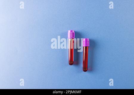 Two blood sample tubes with purple lids, on blue background with copy ...