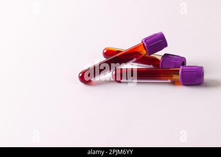 Three blood sample tubes with purple lids, on white background with ...