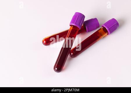Three blood sample tubes with purple lids, on white background with ...