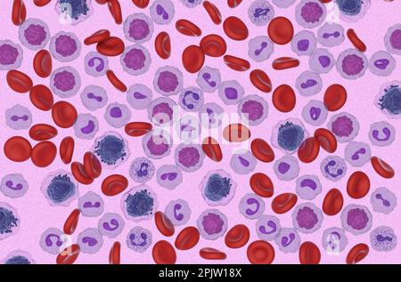 Acute myeloid leukemia (AML) cells in blood flow - isometric view 3d ...