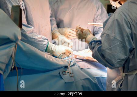 Operating room in pediatric surgery on a child. Pediatric surgery ...