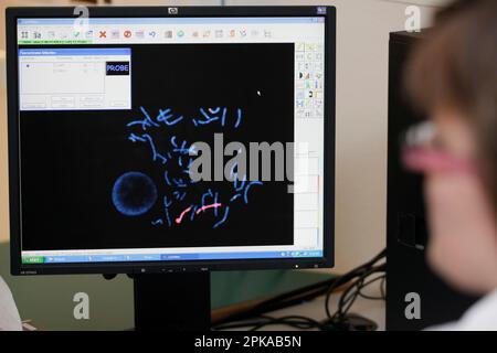 Cytogenetics laboratory, prenatal diagnosis by medical imaging FISH ...