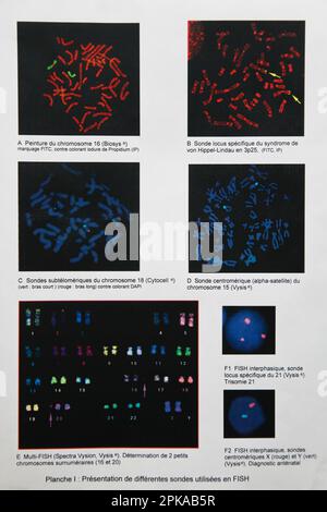 Cytogenetics laboratory, prenatal diagnosis by medical imaging FISH ...
