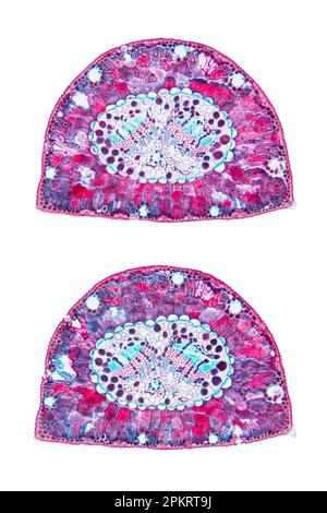 Leaf cross section of pine (Pinus sp.) showing endodermis, epidermis ...