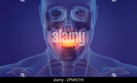 Animation of a painful teeth Stock Photo - Alamy