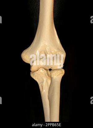 CT scan of elbow joint 3d rendering Stock Photo - Alamy