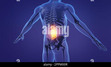 Animation of a painful human spine Stock Photo - Alamy