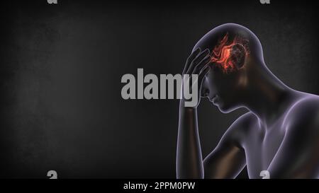 Concept of stress, anxiety and depression. Dark thoughts running ...