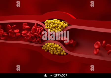 3d illustration, apolipoprotein, arteria, arteries, artery ...